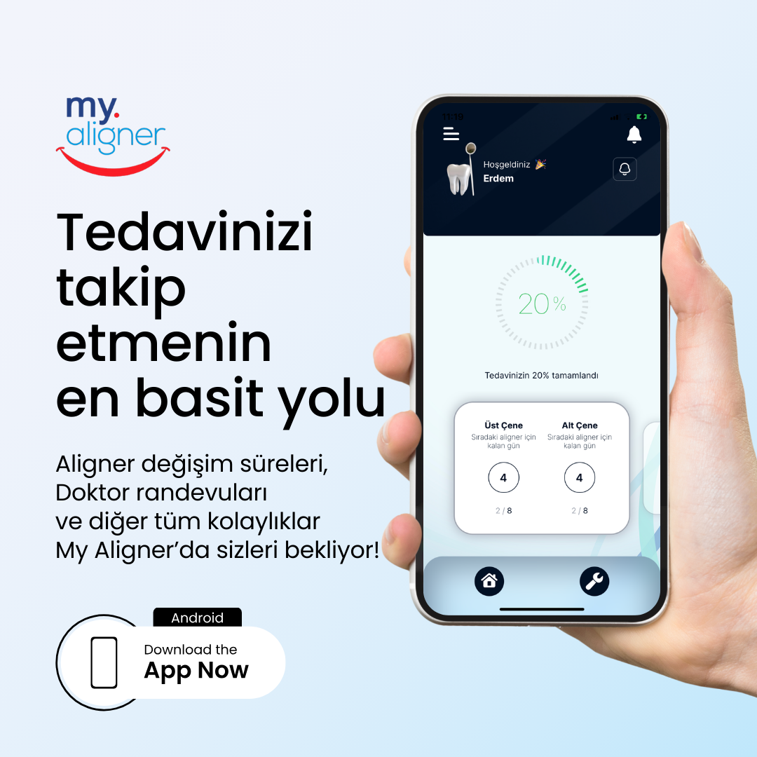 MyAligner - Istanbul Aligner